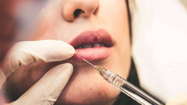 Why full lips are more attractive? - Celebrity Laser & Skin Care