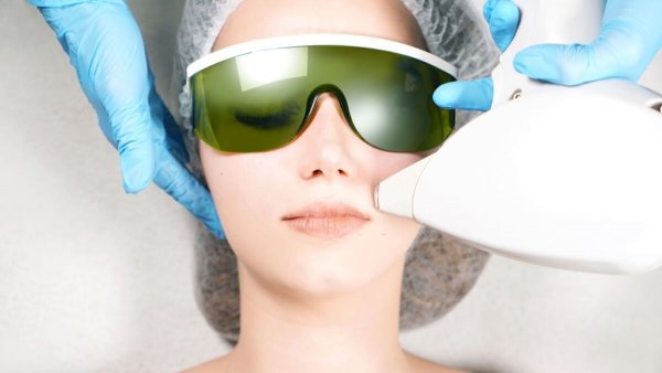 Is limelight the same as IPL? - Celebrity Laser & Skin Care