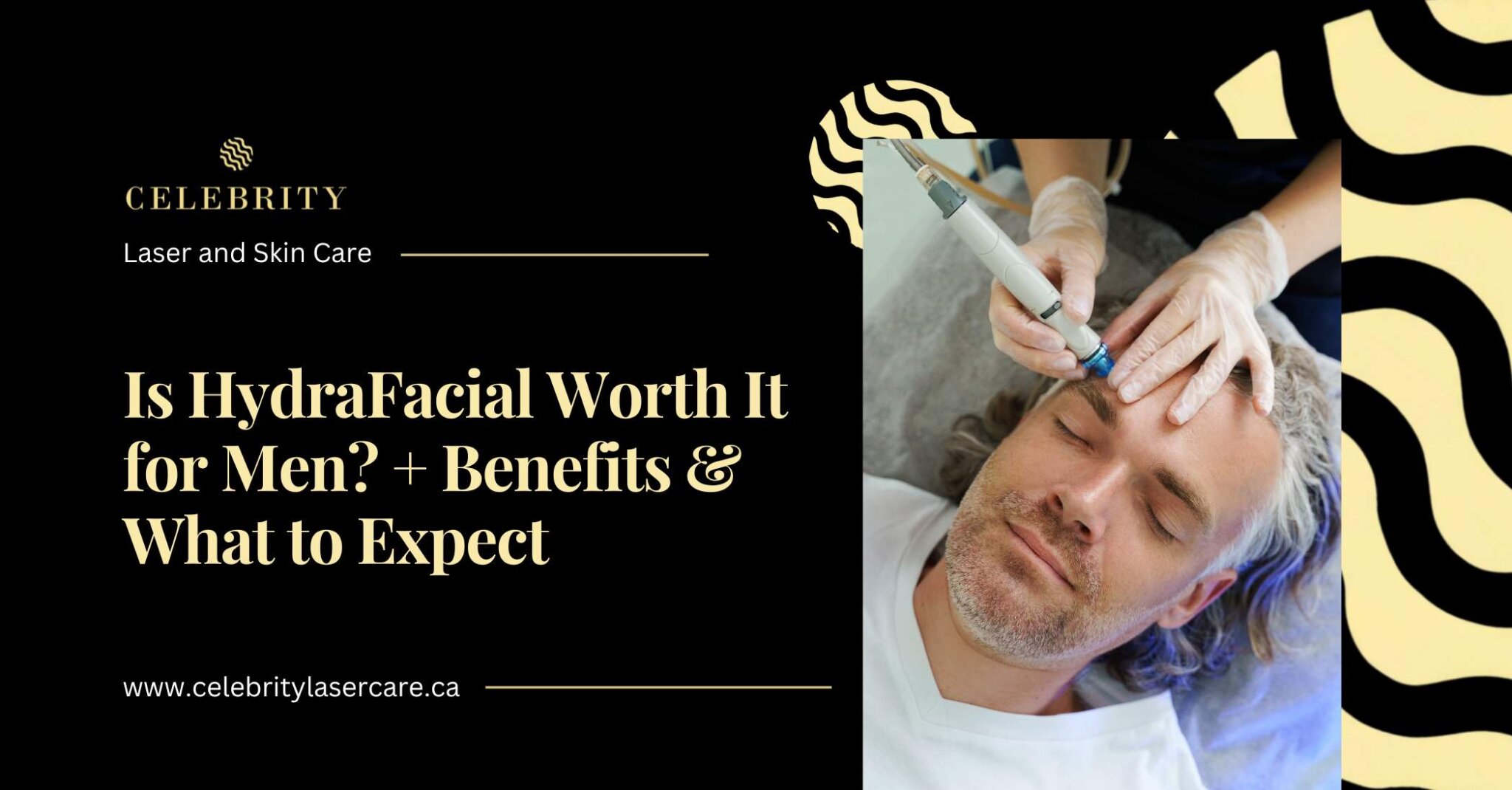 Is HydraFacial Worth It for Men? Benefits + What to Expect!