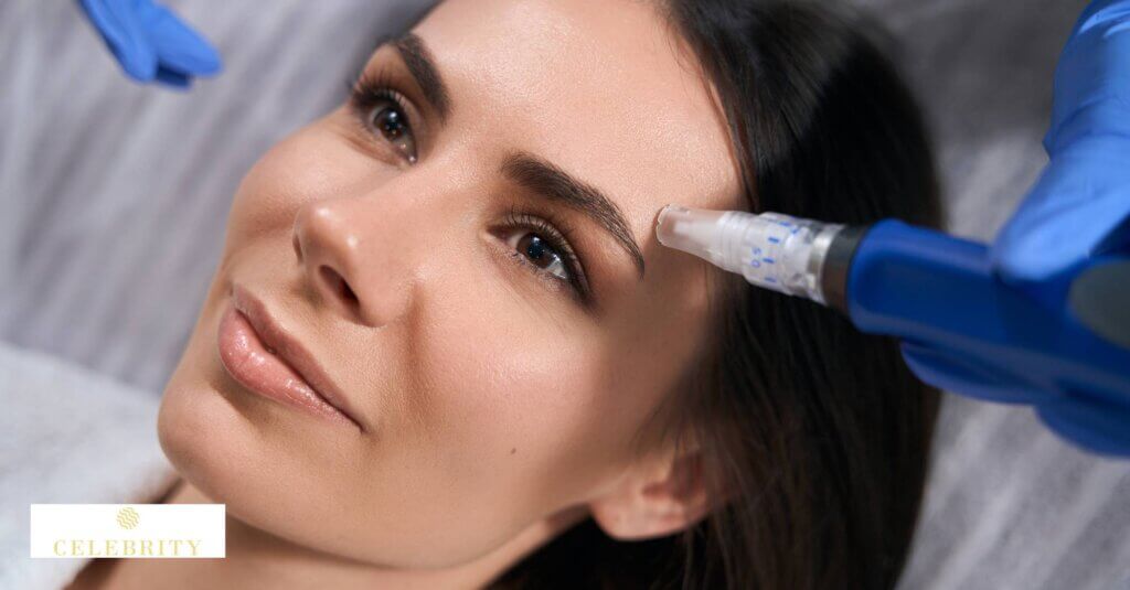 Microneedling Aftercare: What to Expect and Do - Celebrity Laser & Skin ...