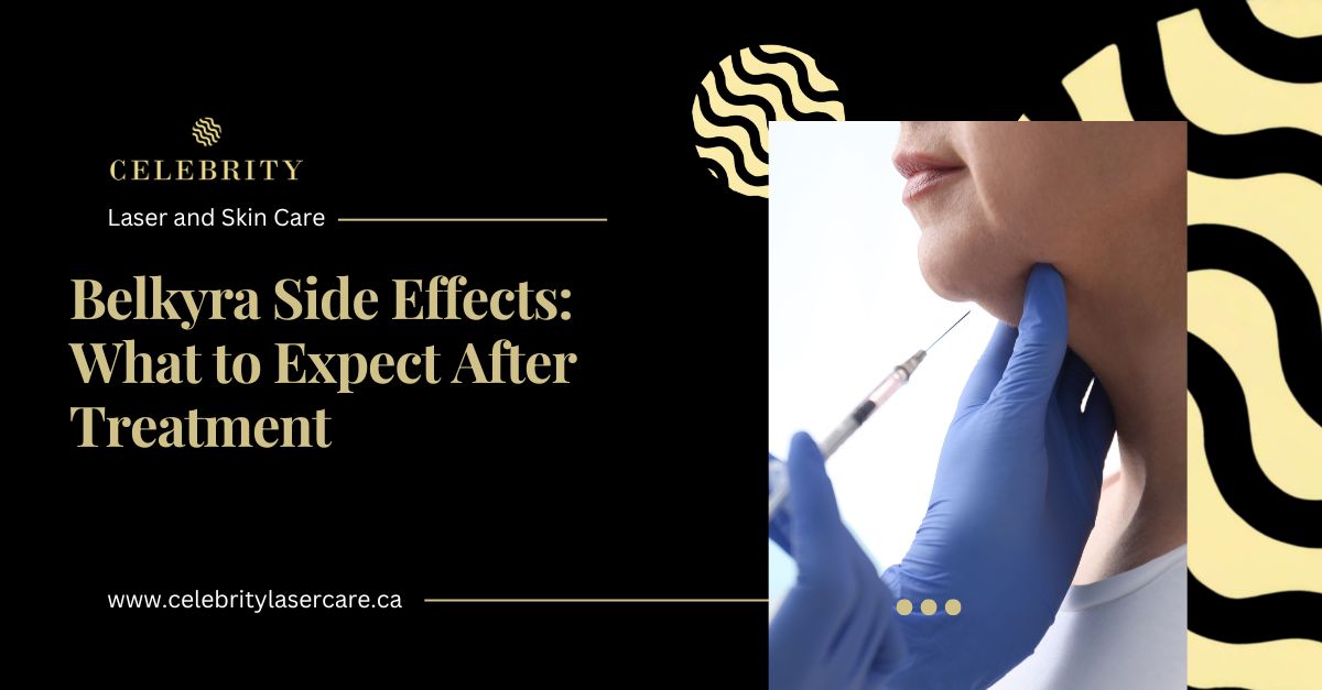 Belkyra Side Effects: What to Expect After Treatment | celebritylasercare