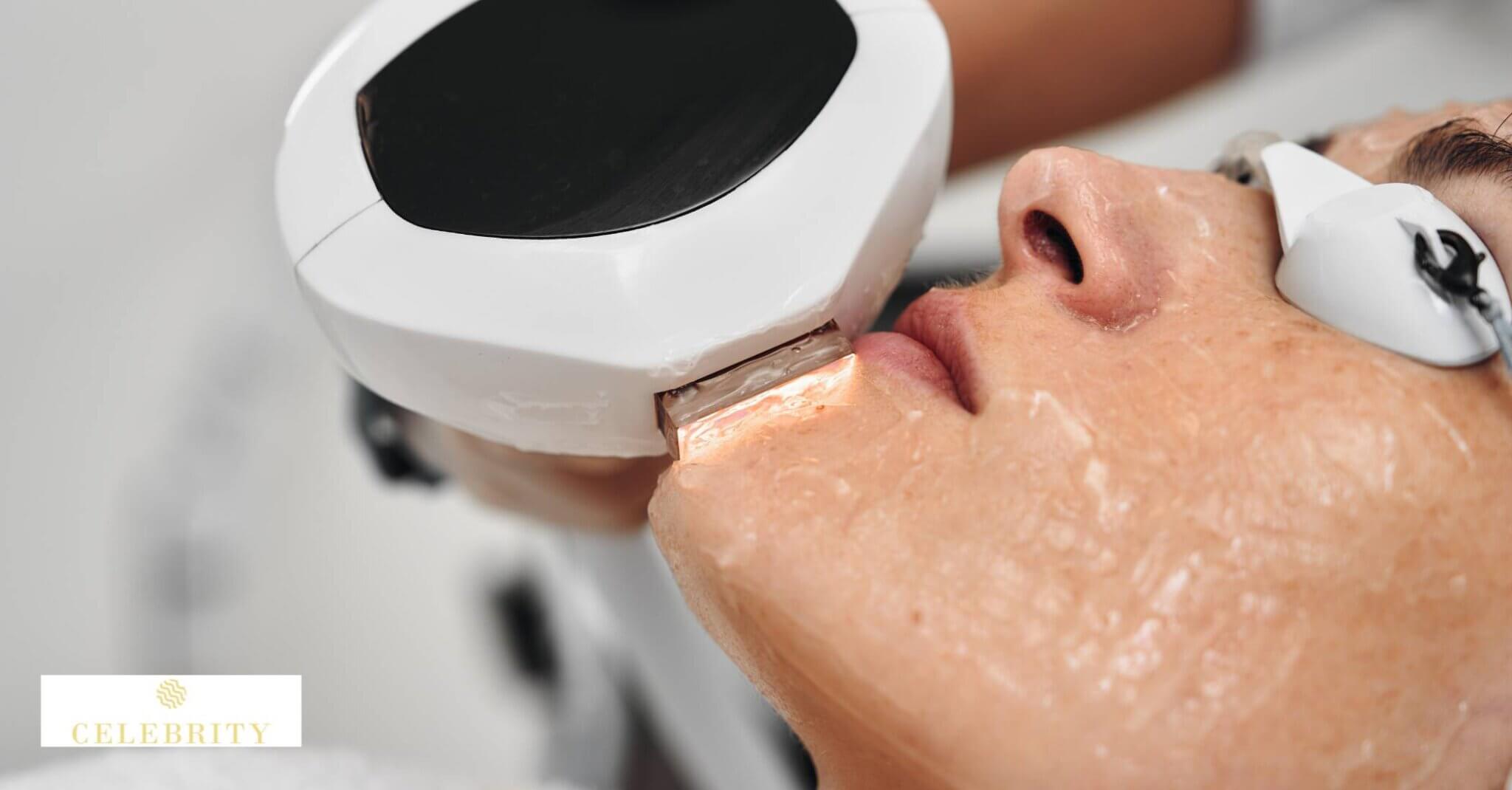 What is the IPL? Understanding Intense Pulsed Light Therapy - Celebrity Laser & Skin Care