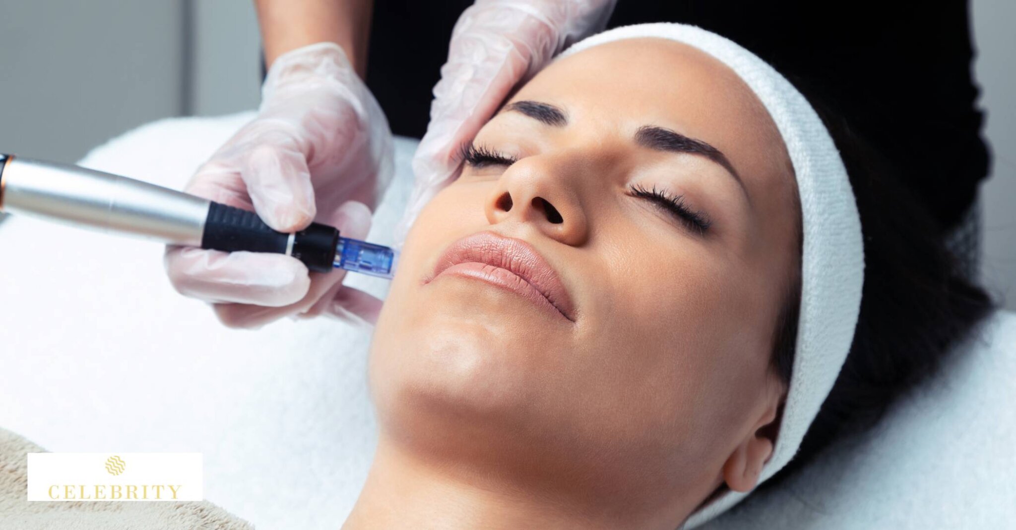 What is Microneedling? Benefits and Costs - Celebrity Laser & Skin Care