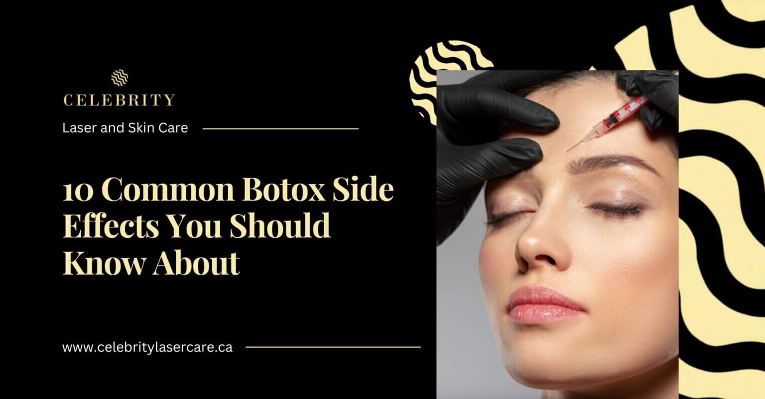 10 Common Botox Side Effects You Should Know About! - Celebrity Laser ...