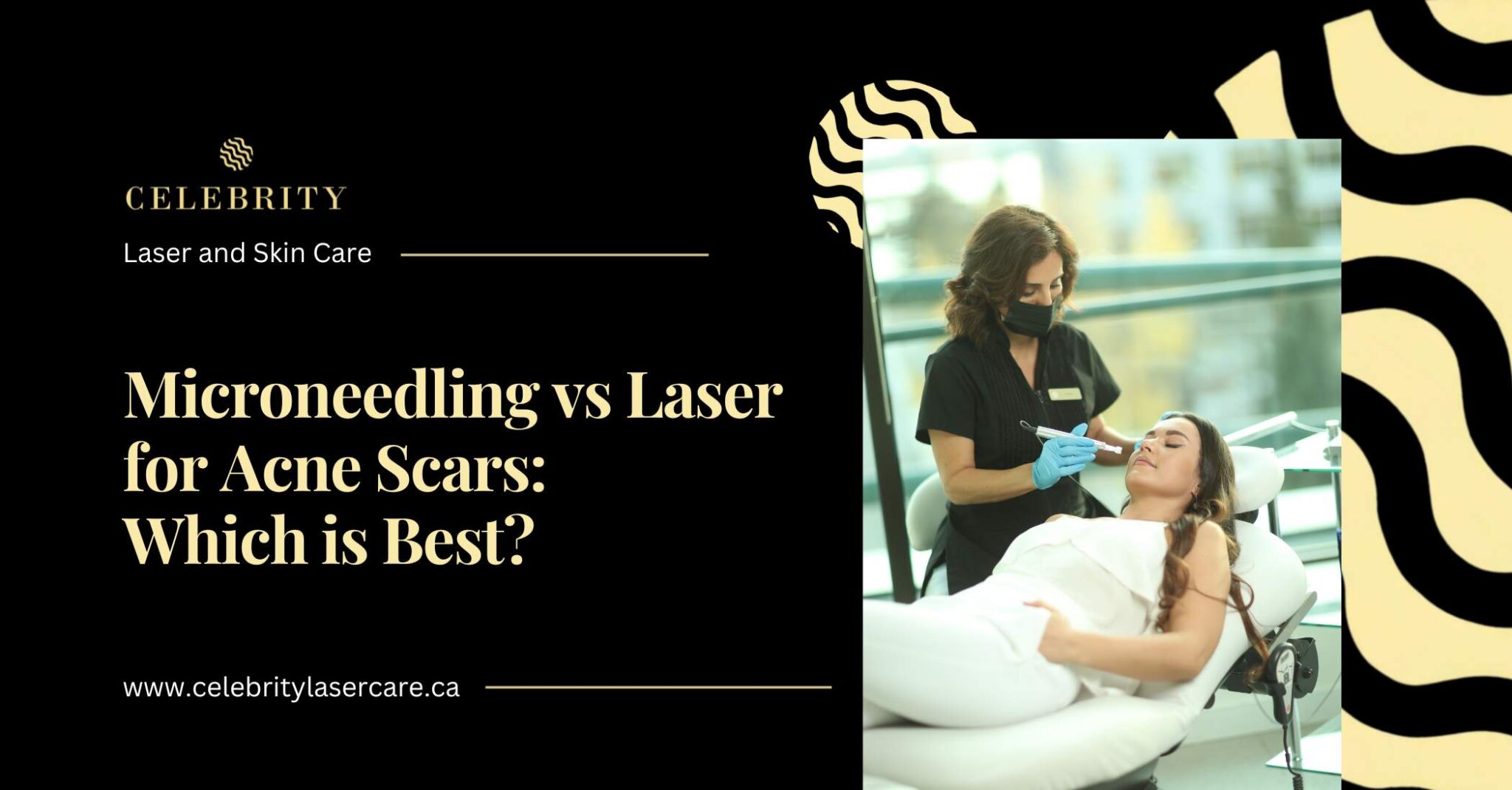 Microneedling vs Laser for Acne Scars: Which is Best?