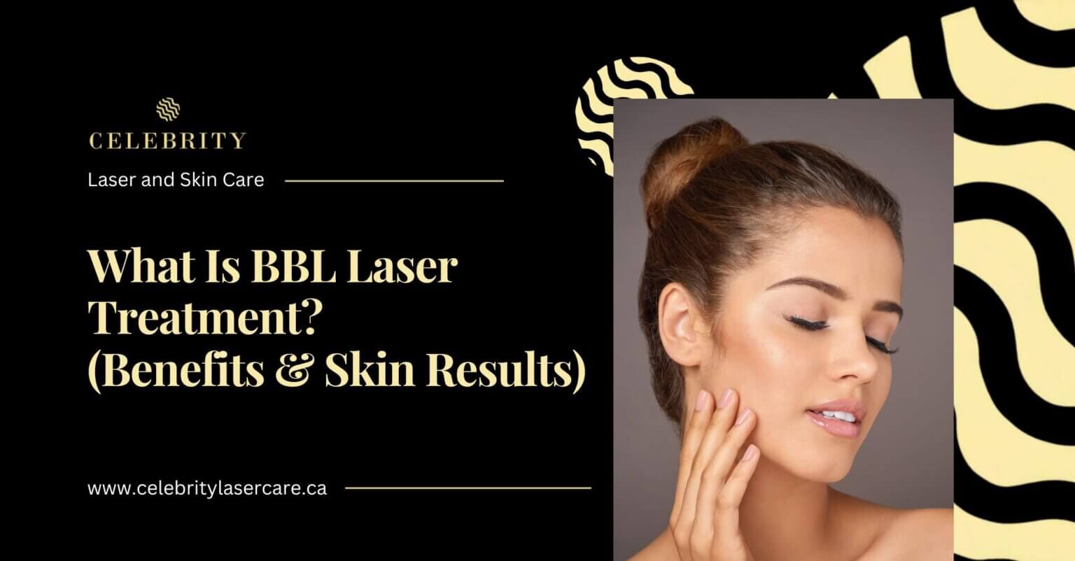 What Is BBL Laser Treatment? (Benefits & Skin Results)