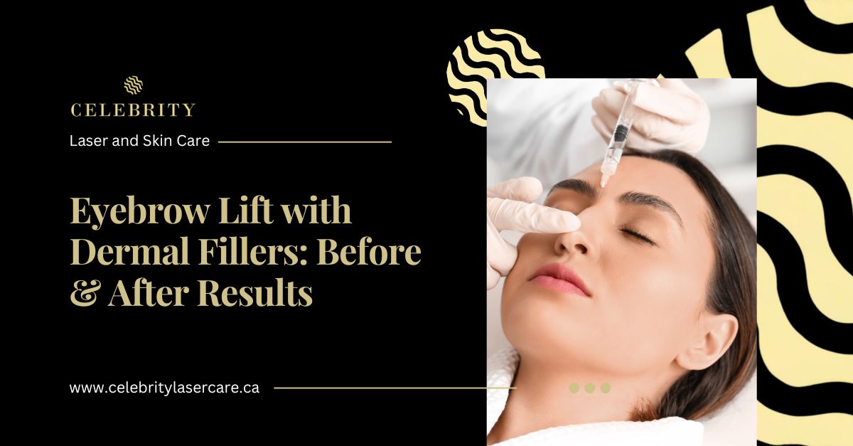 Eyebrow Filler Lift: Before & After, Safety, Results