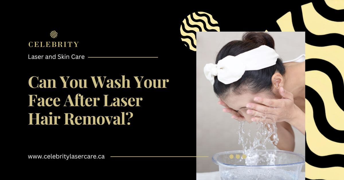 Can You Wash Your Face After Laser Hair Removal?