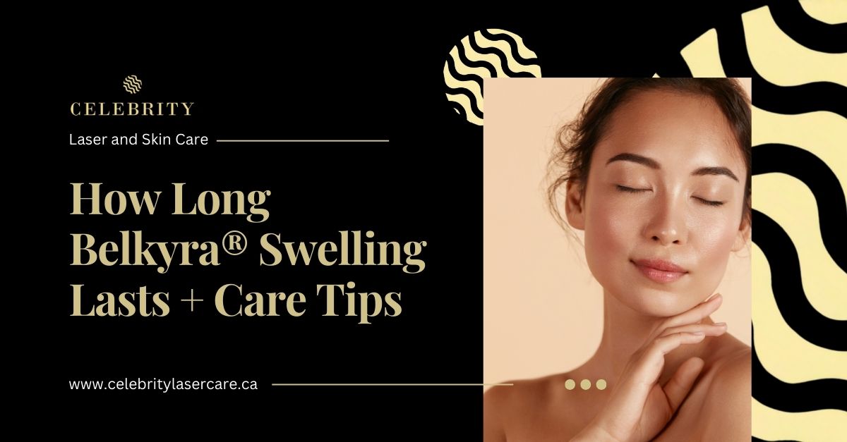 How Long Belkyra® Swelling Lasts + Care Tips - Celebrity Laser & Skin Care
