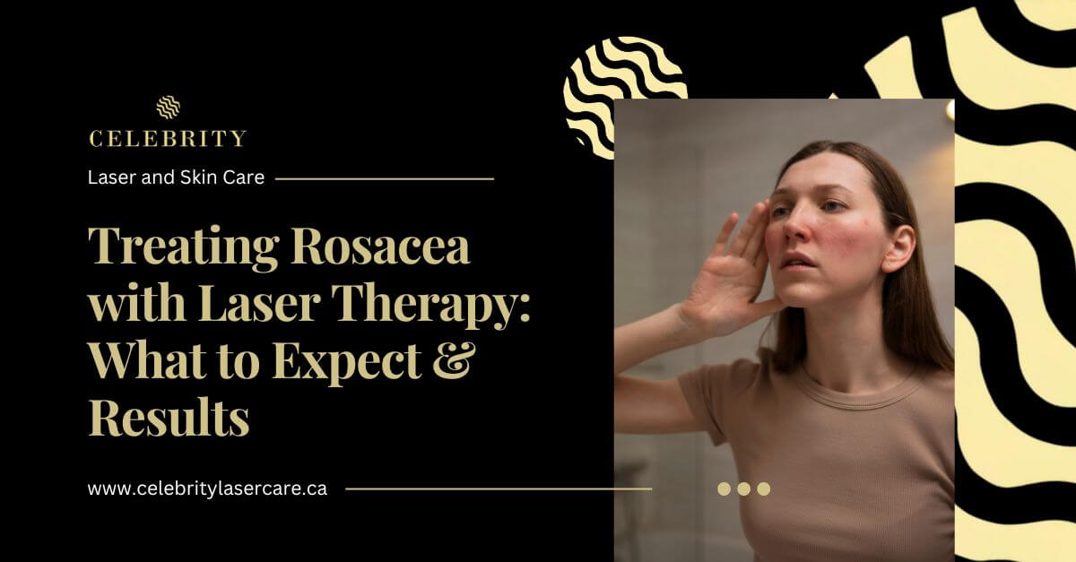 Treating Rosacea with Laser Therapy: What to Expect & Results