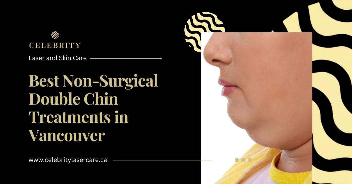 How to Lose a Double Chin Fast Without Surgery - Celebrity Laser & Skin ...